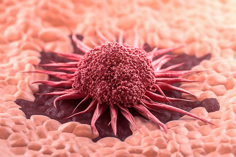 Adjuvant cemiplimab prolongs DFS in cutaneous SCC | Multidisciplinary ...