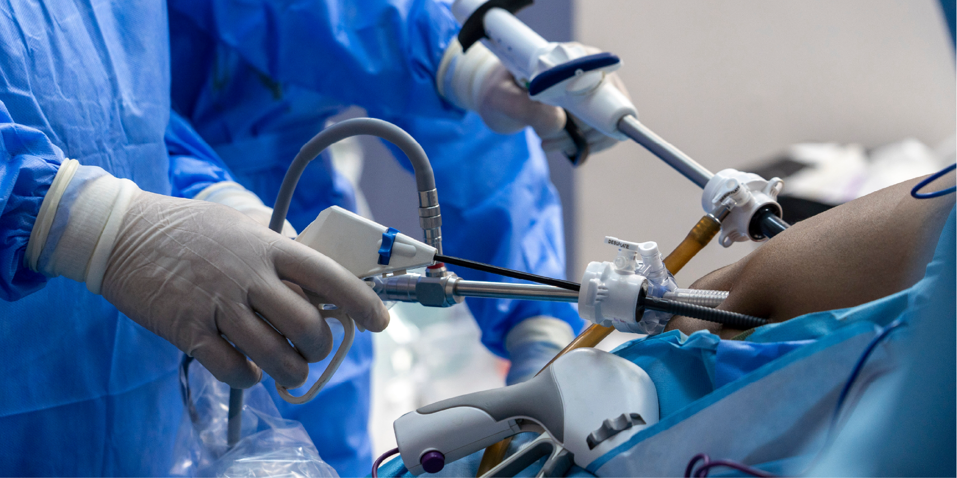 Gastric Cancer : Management | MIMS Hong Kong