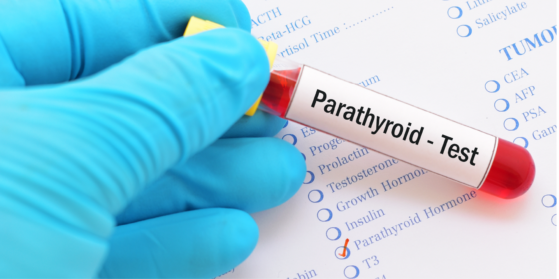 Hyperparathyroidism : Diagnostics | MIMS Singapore