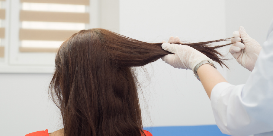 Alopecia : Initial Assessment | MIMS Thailand